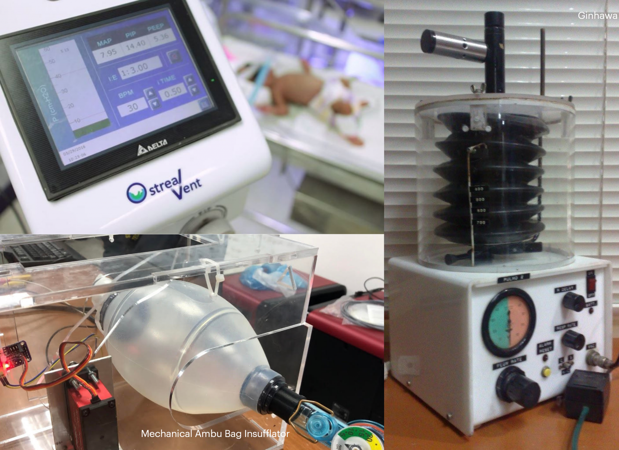 UPCM faculty addresses need for more ventilators - University of the ...